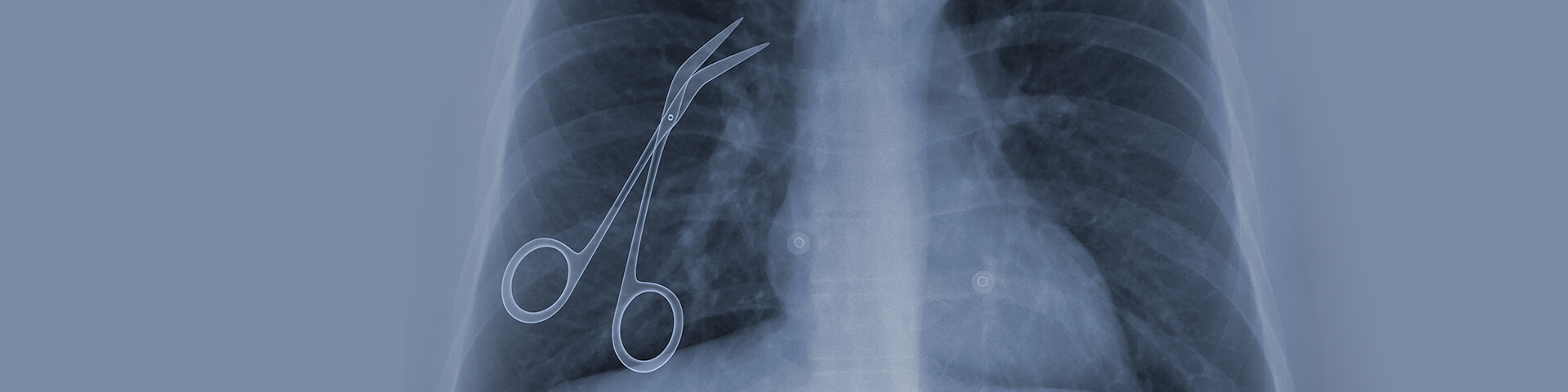 Surgical Error Malpractice Attorneys, Hartford CT | Walsh Woodard LLC